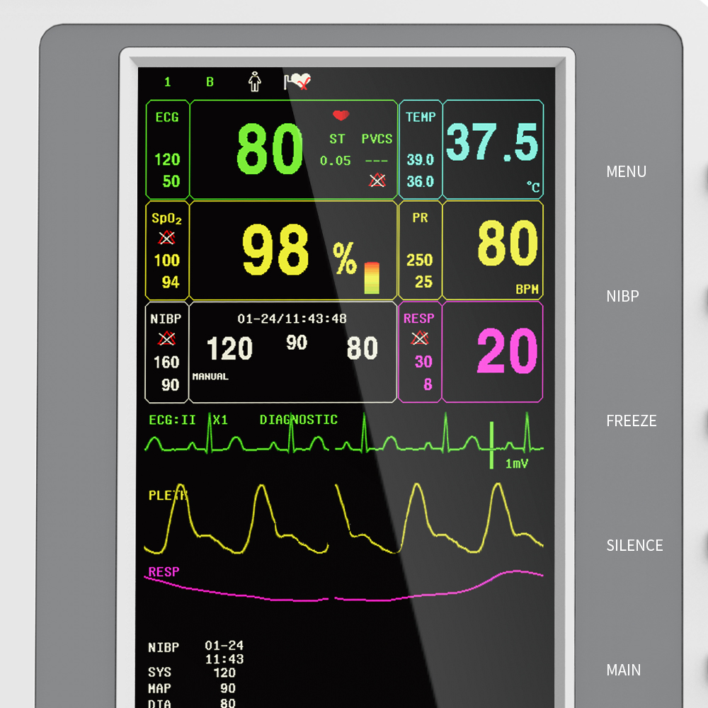 Patient Monitor 7'' TFT Color LCD Screen ECG,RESP,SpO2,PR,NIBP,TEMP ...