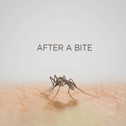 Bug Bite Suction Remover