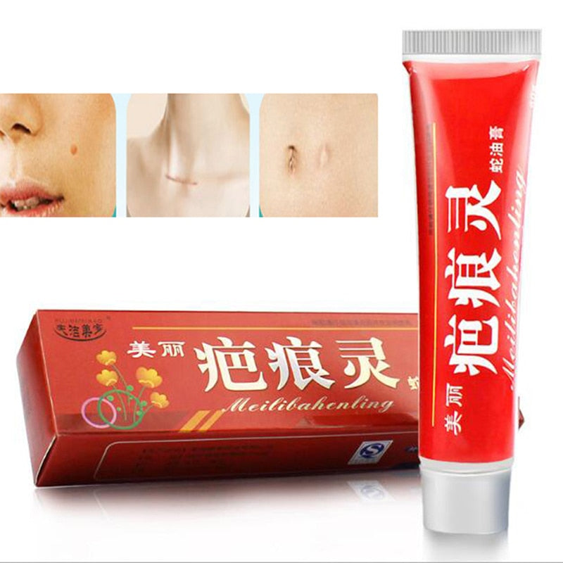 1Pc Ointment 60g Snake Essence Ointment Scar Remove Cream Acne ...