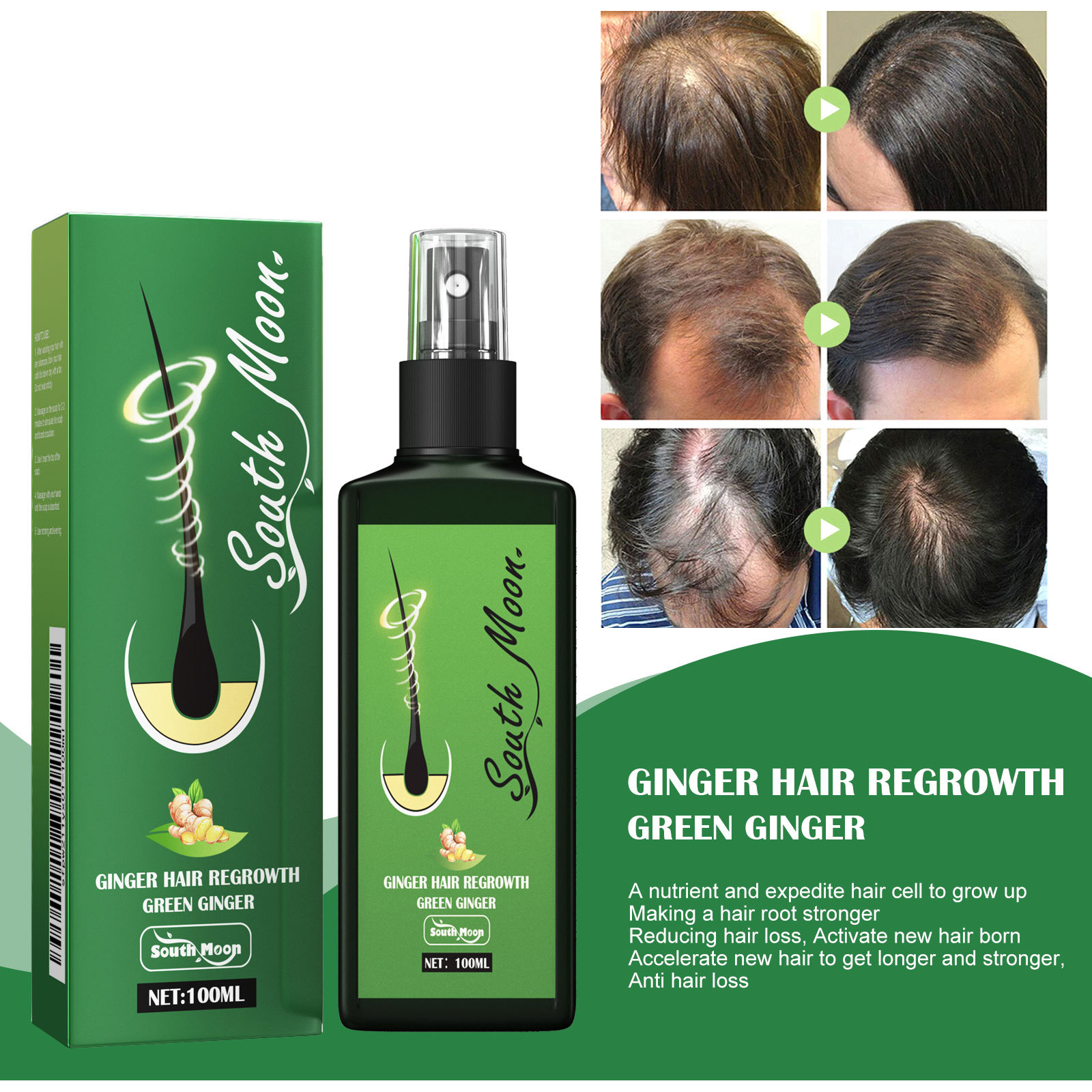 💓Limited-time 50% discount - Ginger Nourishing Hair Growth Spray ...