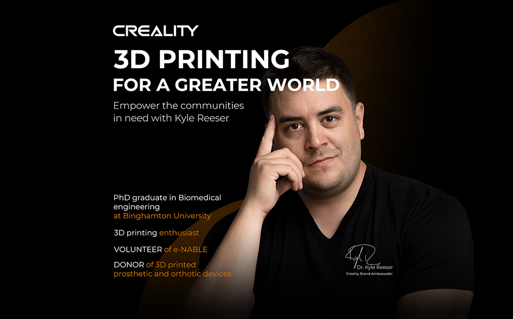 Lending a Hand: A Creality User's Mission to Provide Prosthetic Devices ...