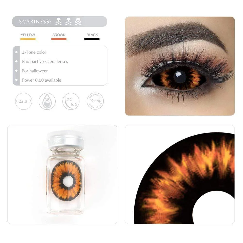 Radioactive Sclera Contacts