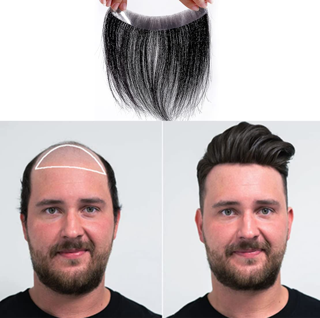 HAIR SYSTEM
