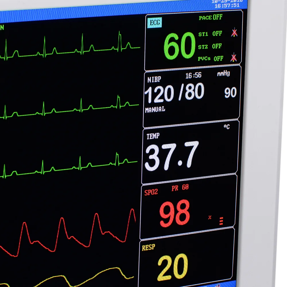Patient Monitor 8 Inch ICU CCU Vital Sign 6 Parameter Rechargeable SpO2 ...