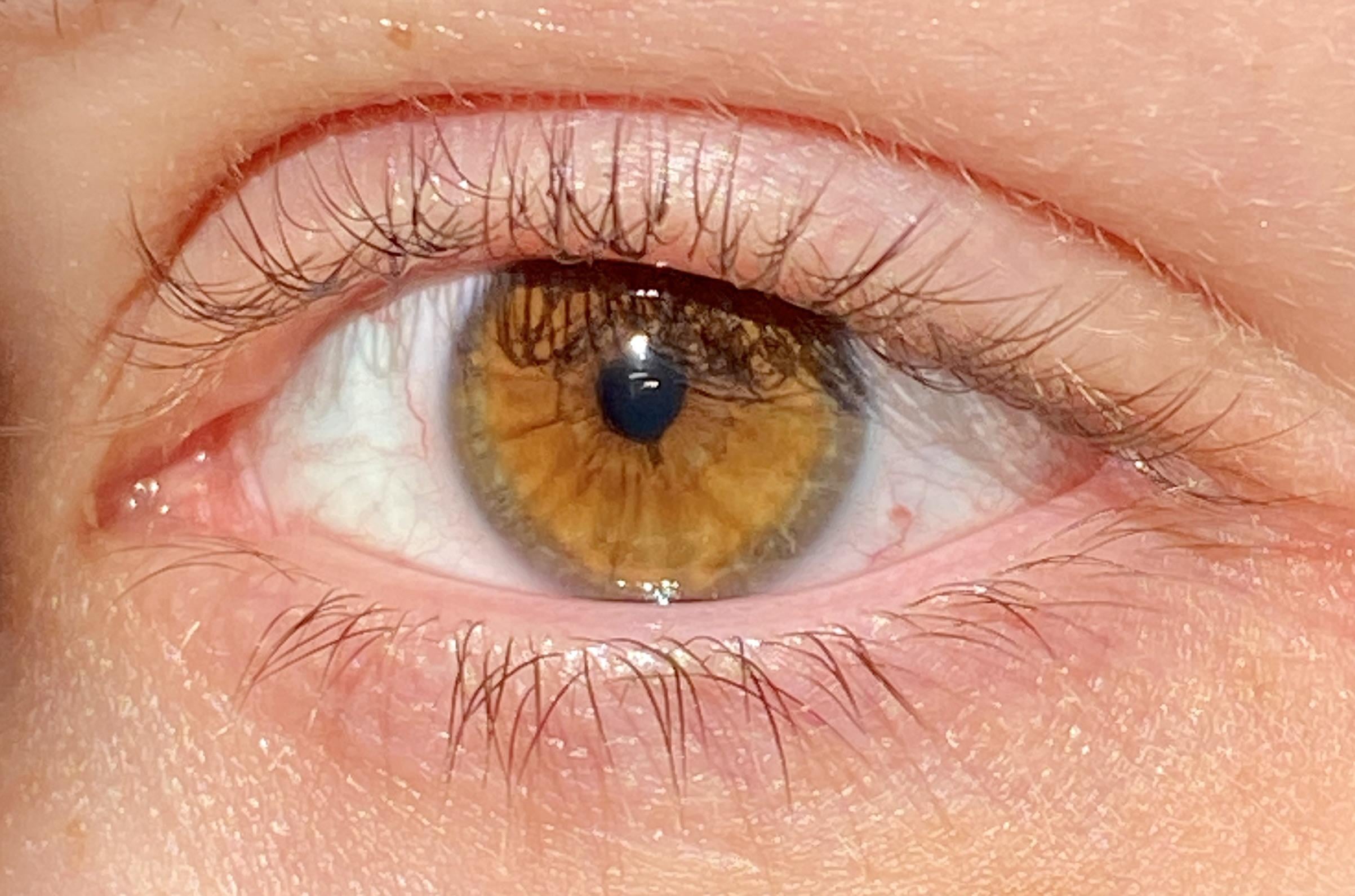 How Rare Are Amber Eyes? Facts About This Rare Eye Color | ICOICE