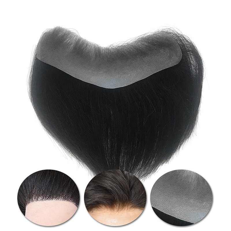 Frontal Hairline