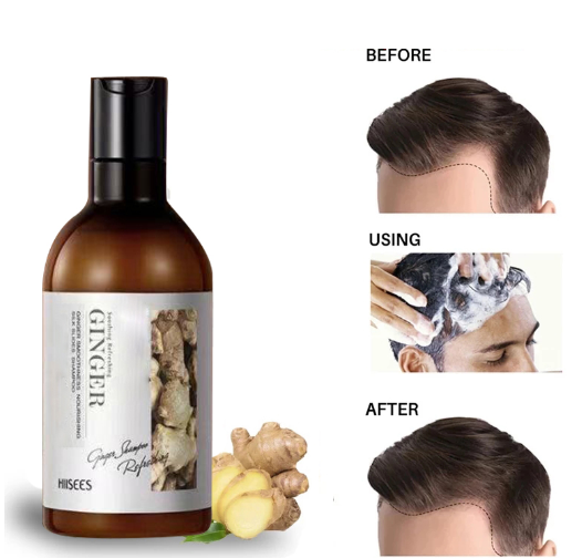Ginger Anti Hair Loss And Hair Regrowth Shampoo